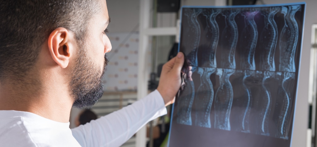 Comprehensive Guide to Spinal Cord Injuries and Legal Options